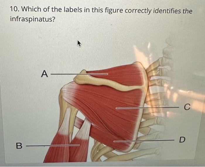 Solved one in between that is called the intermediate layer. | Chegg.com