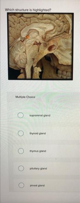 Solved Which structure is highlighted? Multiple Choice arm | Chegg.com