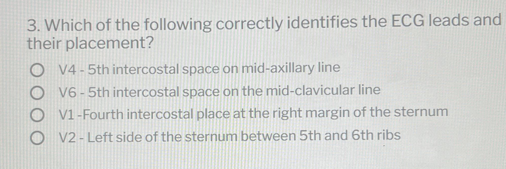 Solved Which of the following correctly identifies the ECG | Chegg.com