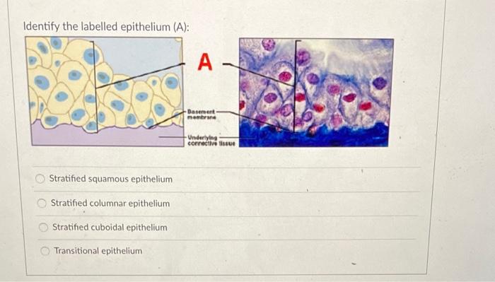 Solved Identify the labelled epithelium (A): Simple cuboidal | Chegg.com