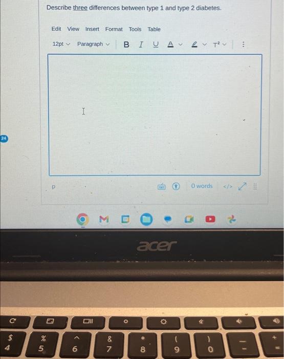 Describe three differences between type 1 and type 2 | Chegg.com
