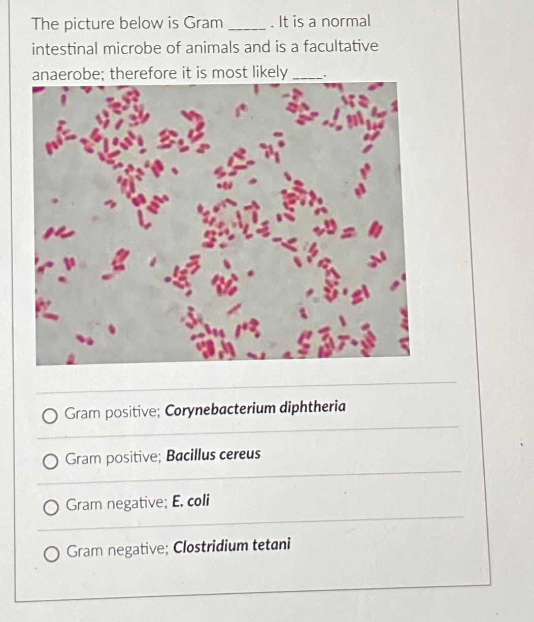 Solved The picture below is Gram q, . ﻿It is a normal | Chegg.com