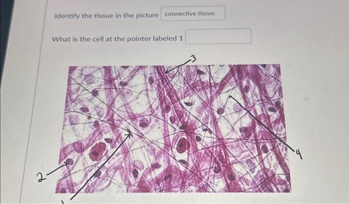 Solved 9. Identify the tissue in the picture connective | Chegg.com