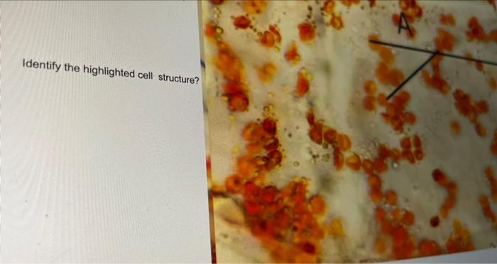 Solved A Identify The Highlighted Cell Structure 1793