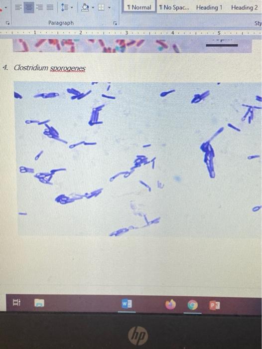 Solved Lab Report 4: The Endospore Stain Name: Team: Due on | Chegg.com