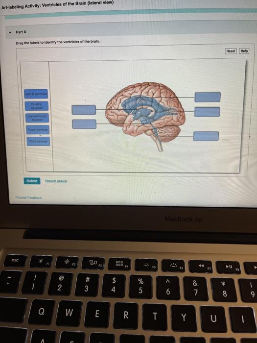 Solved Art-labeling Activity: Ventricles of the Brain | Chegg.com