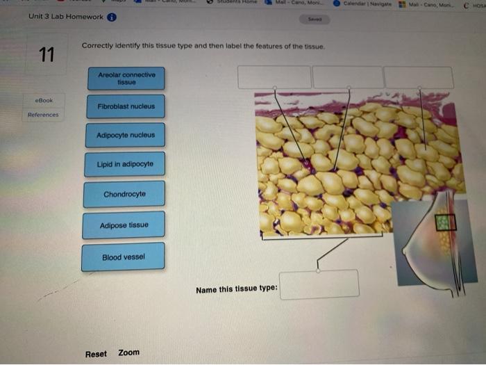 Solved Unit 3 Lab Homework Correctly identify this tissue | Chegg.com
