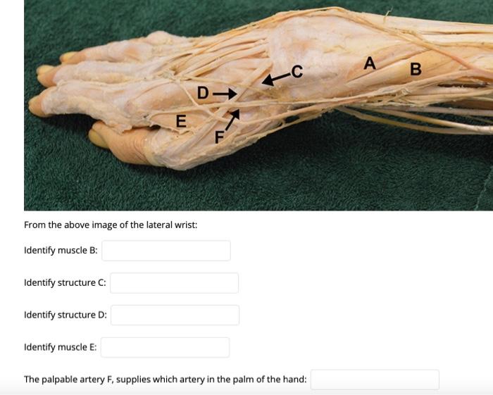 Solved From the above image of the lateral wrist: Identify | Chegg.com Solved From the above image of the lateral wrist: Identify | Chegg.com