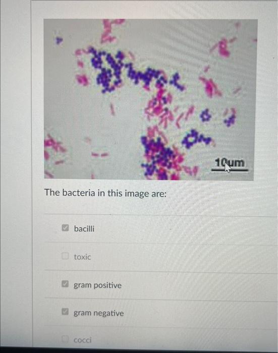 Solved The bacteria in this image are: bacilli toxic gram | Chegg.com