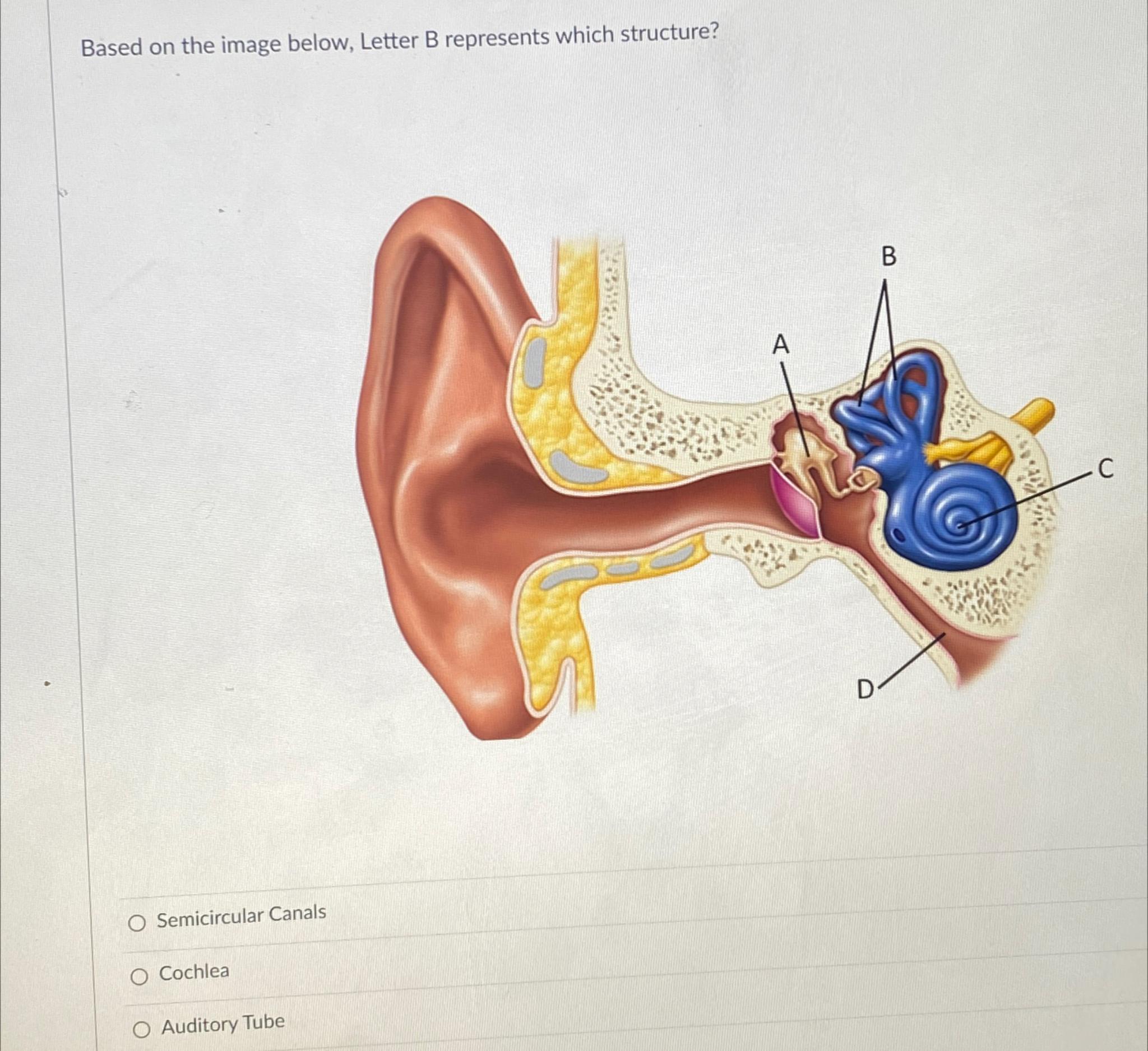 Solved Based on the image below, Letter B represents which | Chegg.com