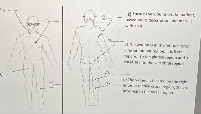 Solved g 6. 8) Locate the wound on the patient, based on its | Chegg.com