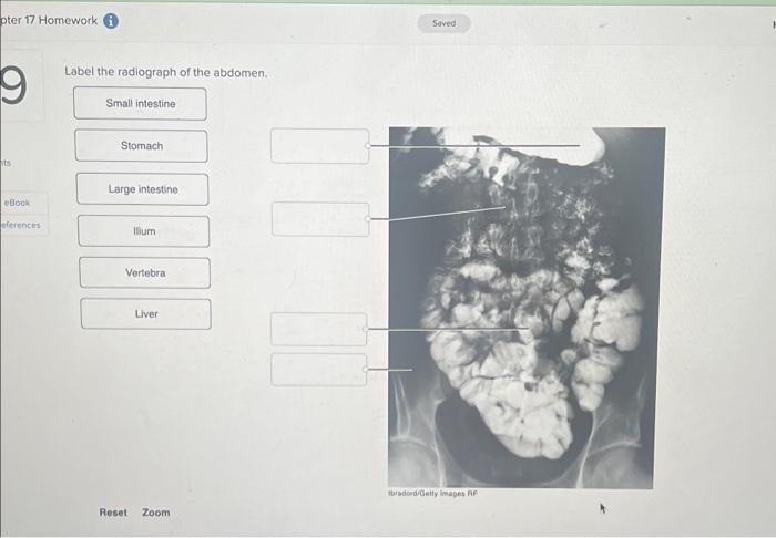 Solved Label the radiograph of the abdomen. | Chegg.com