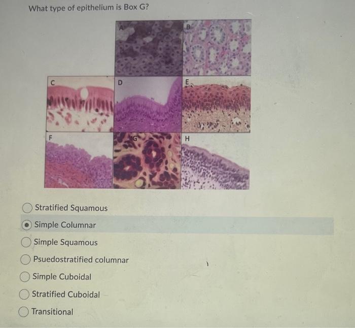 What part of the cell is B ? Apical membrane | Chegg.com