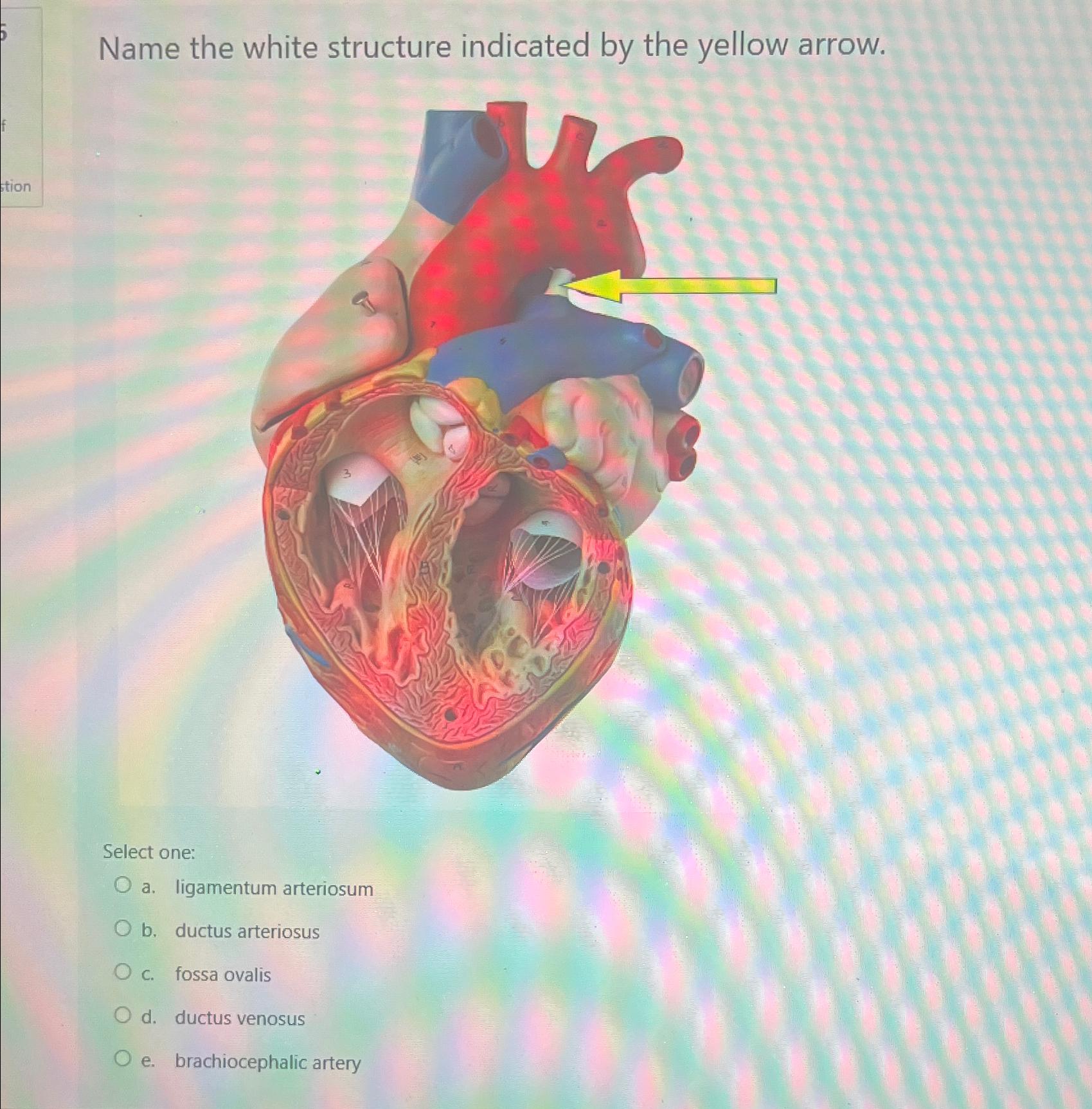 Solved Name the white structure indicated by the yellow | Chegg.com