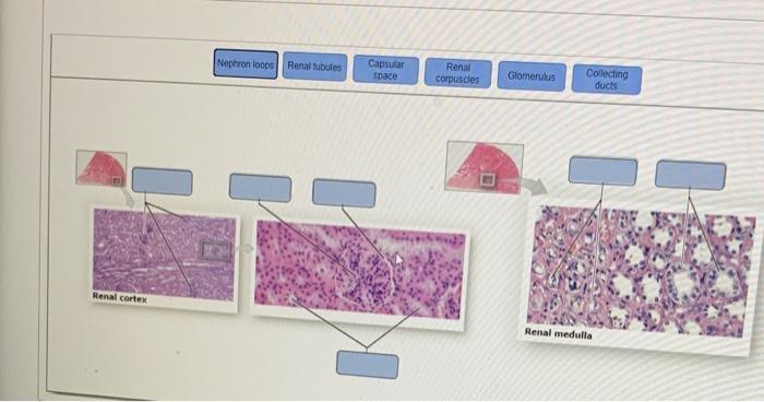 Solved Nephron loops Renal tubules Capsular space Renal | Chegg.com