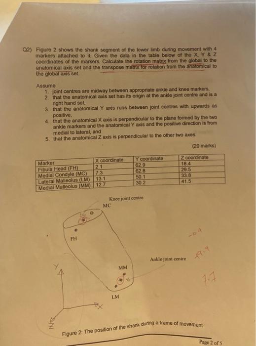 Solved Q2) Figure 2 shows the shank segment of the lower | Chegg.com