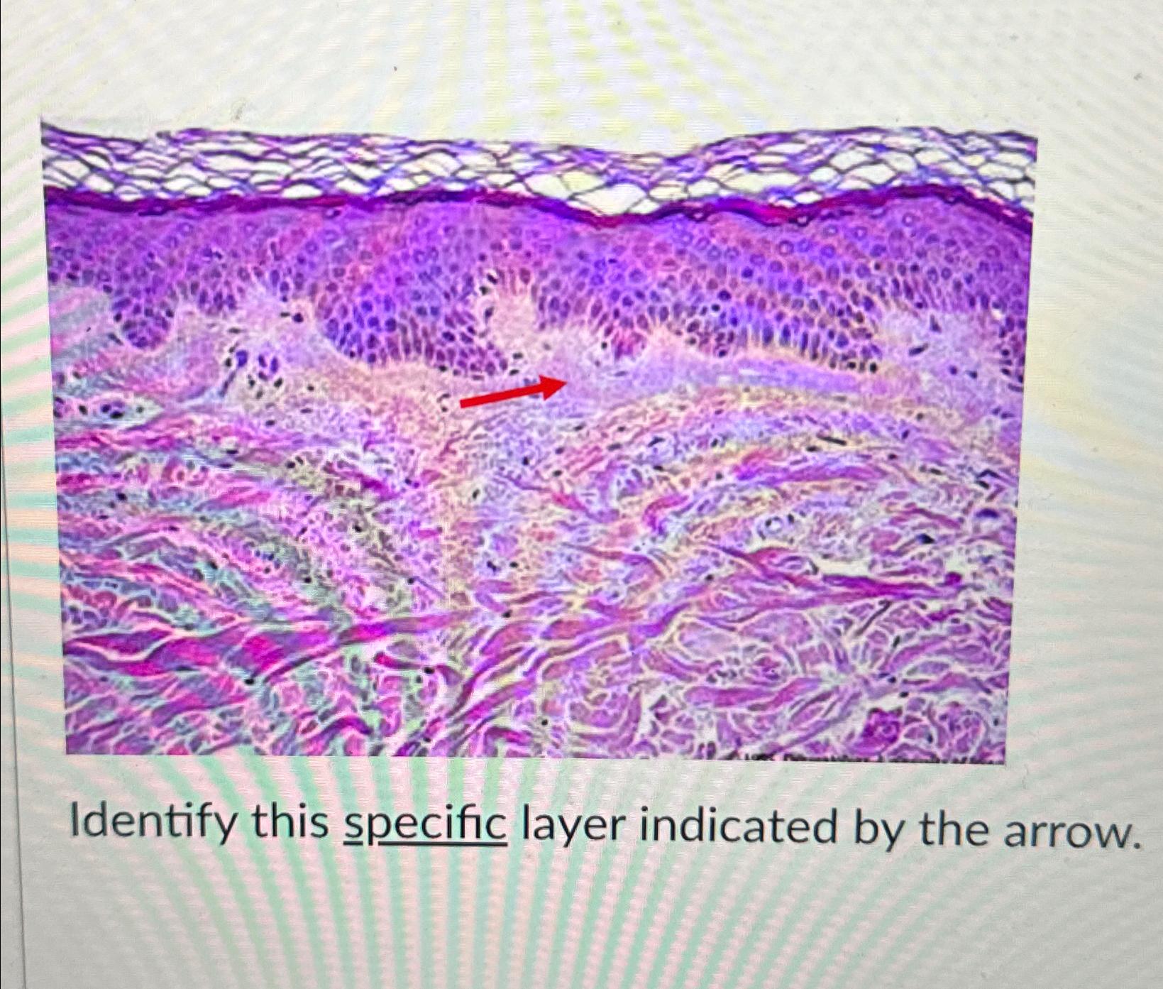 Solved Identify this specific layer indicated by the arrow. | Chegg.com