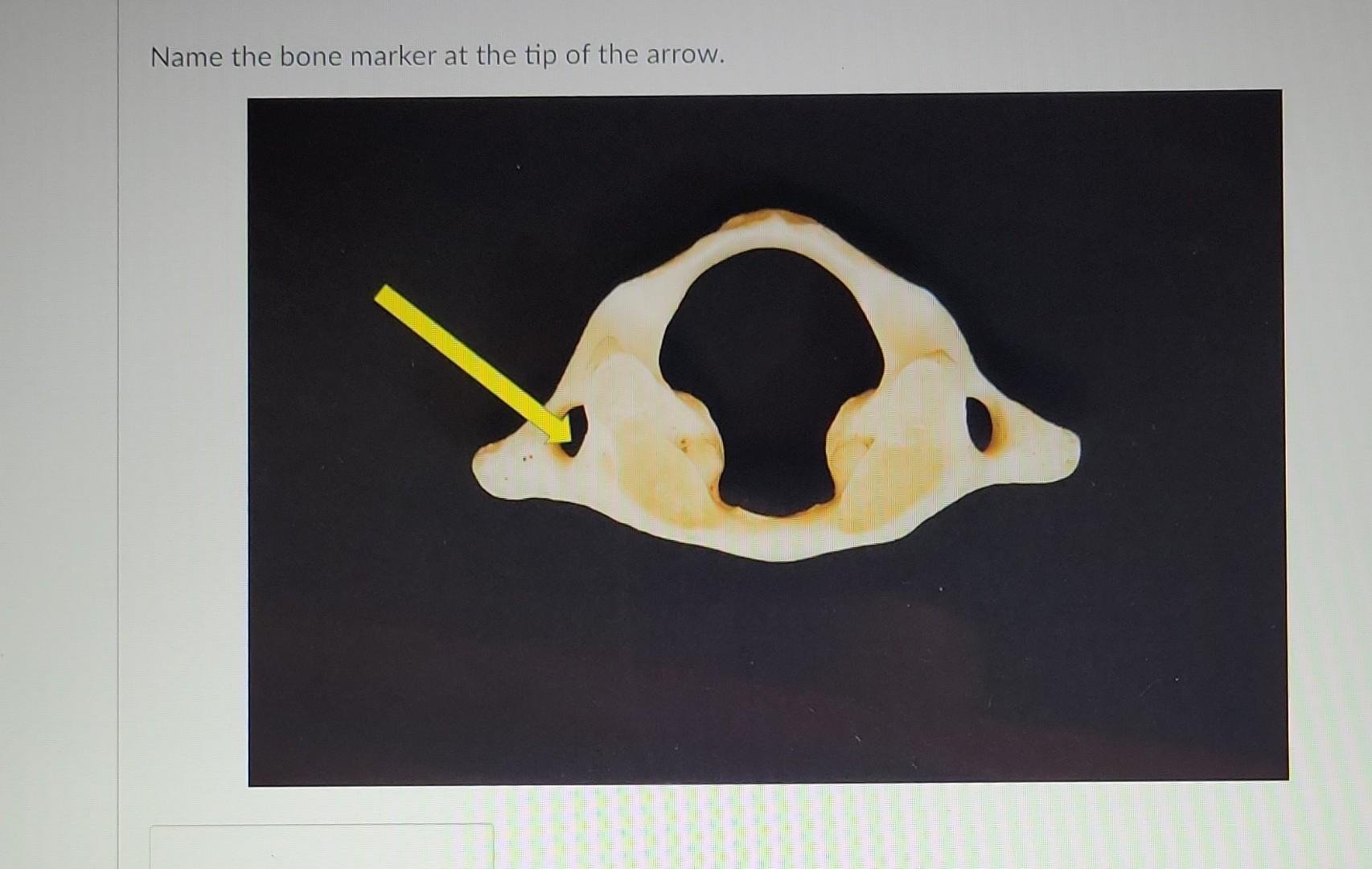 Solved Name the bone marker at the tip of the arrow. Name | Chegg.com