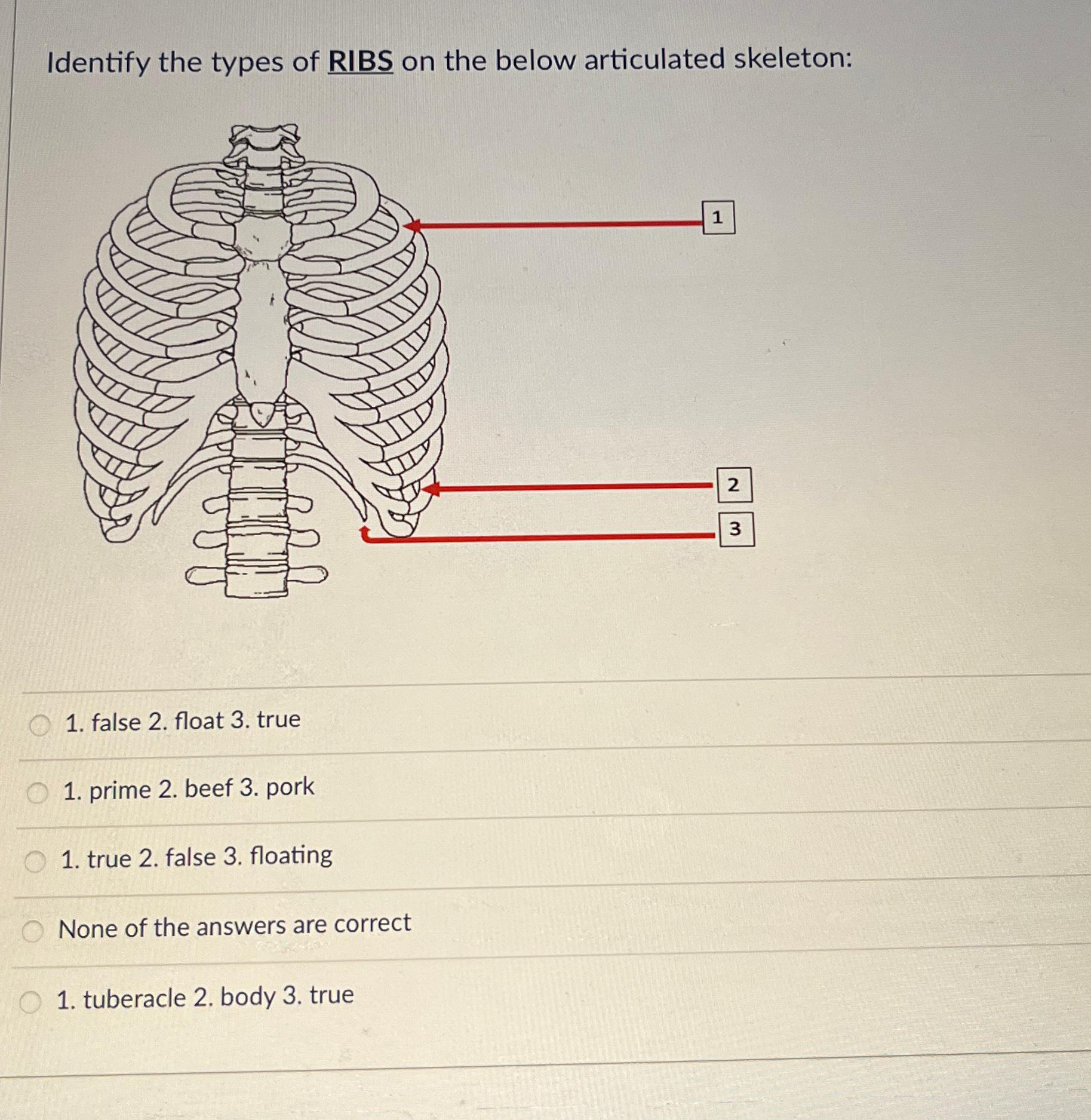 Solved Identify the types of RIBS on the below articulated | Chegg.com