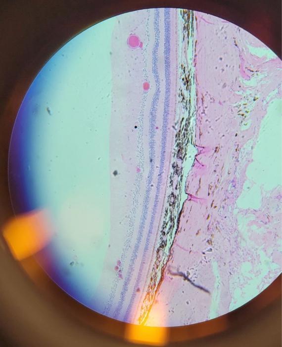 Solved This is a monkey retina we looked at class recently. | Chegg.com