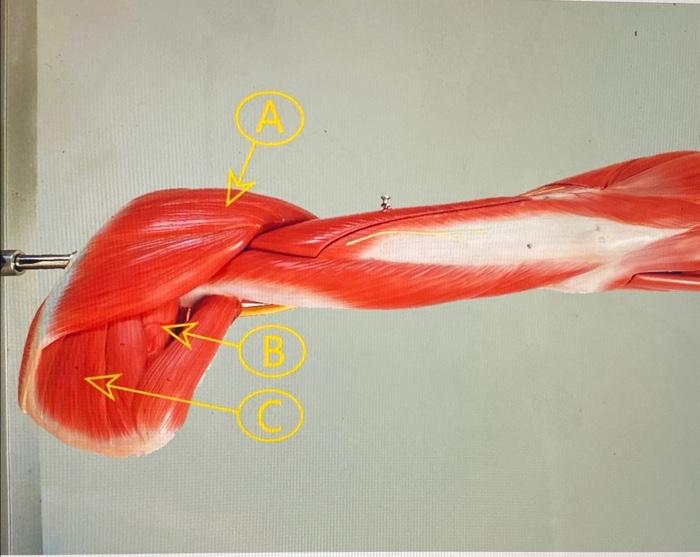 Solved name the muscles | Chegg.com
