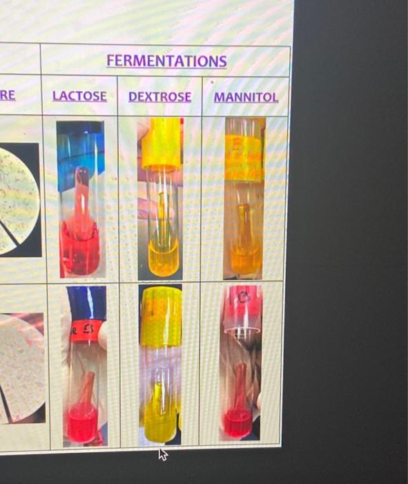 Solved FERMENTATIONS RE LACTOSE DEXTROSE MANNITOL 5 tas & | Chegg.com