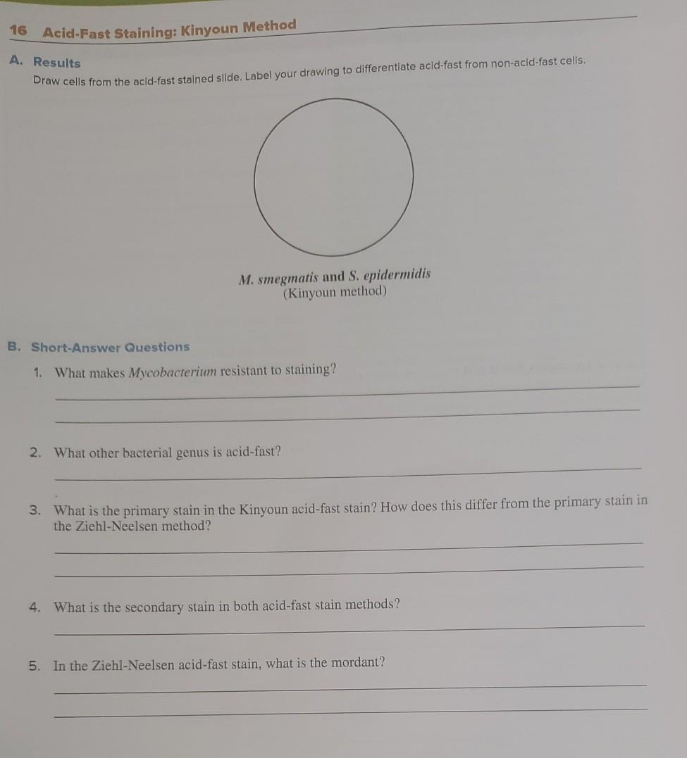 Solved 16 Acid-Fast Staining: Kinyoun Method A. Results Draw | Chegg.com