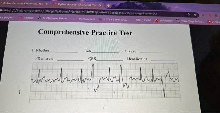 Solved Comprehensive Practice Test 1. Rhythm Rate P wave PR | Chegg.com
