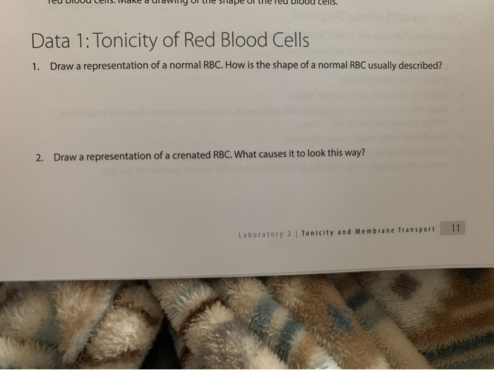 Data 1: Tonicity of Red Blood Cells 1. Draw a | Chegg.com