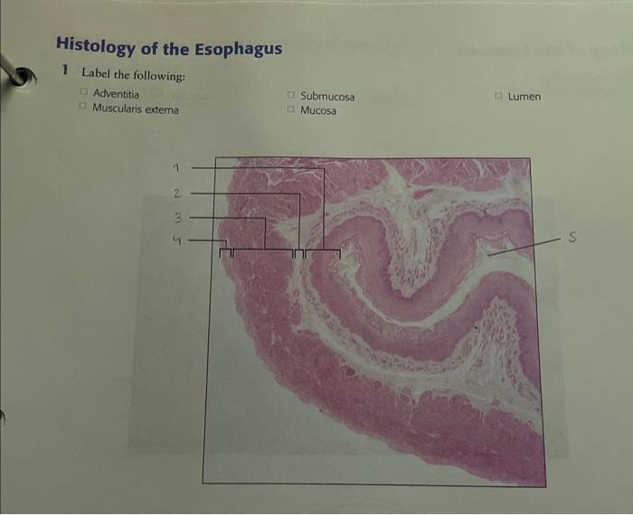 Solved Histology of the Esophagus 1 Label the following: 10 | Chegg.com
