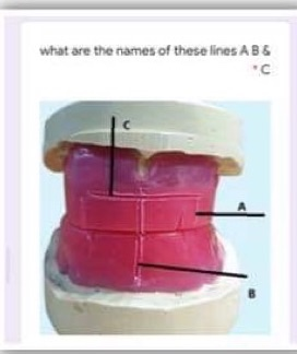 Solved What are the names of these lines ABS "C | Chegg.com