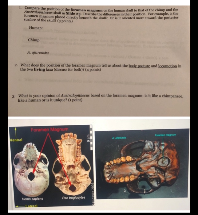 Solved: 1. Com Compare The Position Of The Foramen Maenum ... | Chegg.com