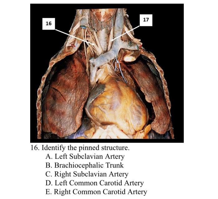 [Solved]: 16. Identify the pinned structure. A. Left Subcla