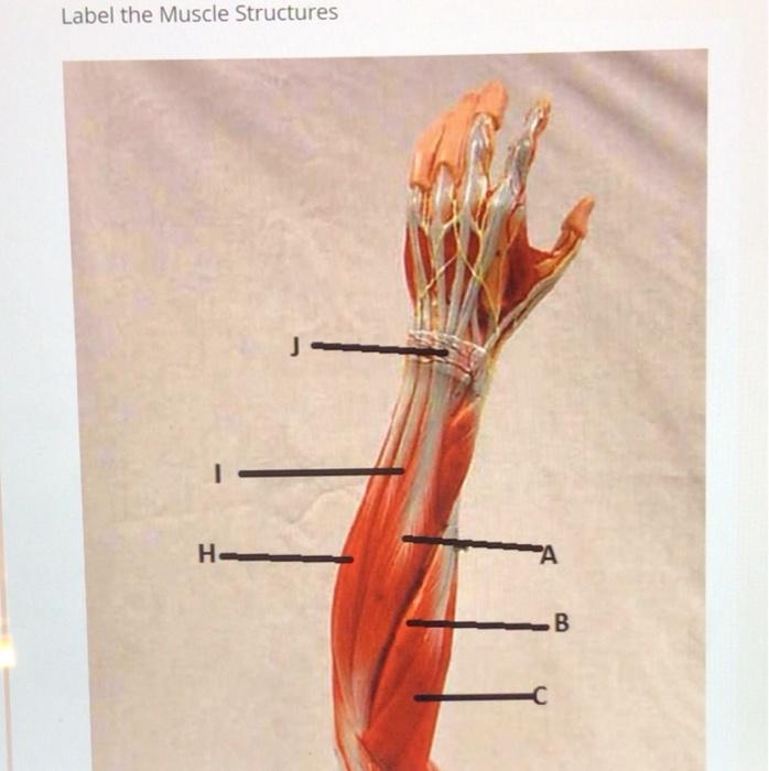 Label the Muscle Structures A. Brachlalls B. | Chegg.com