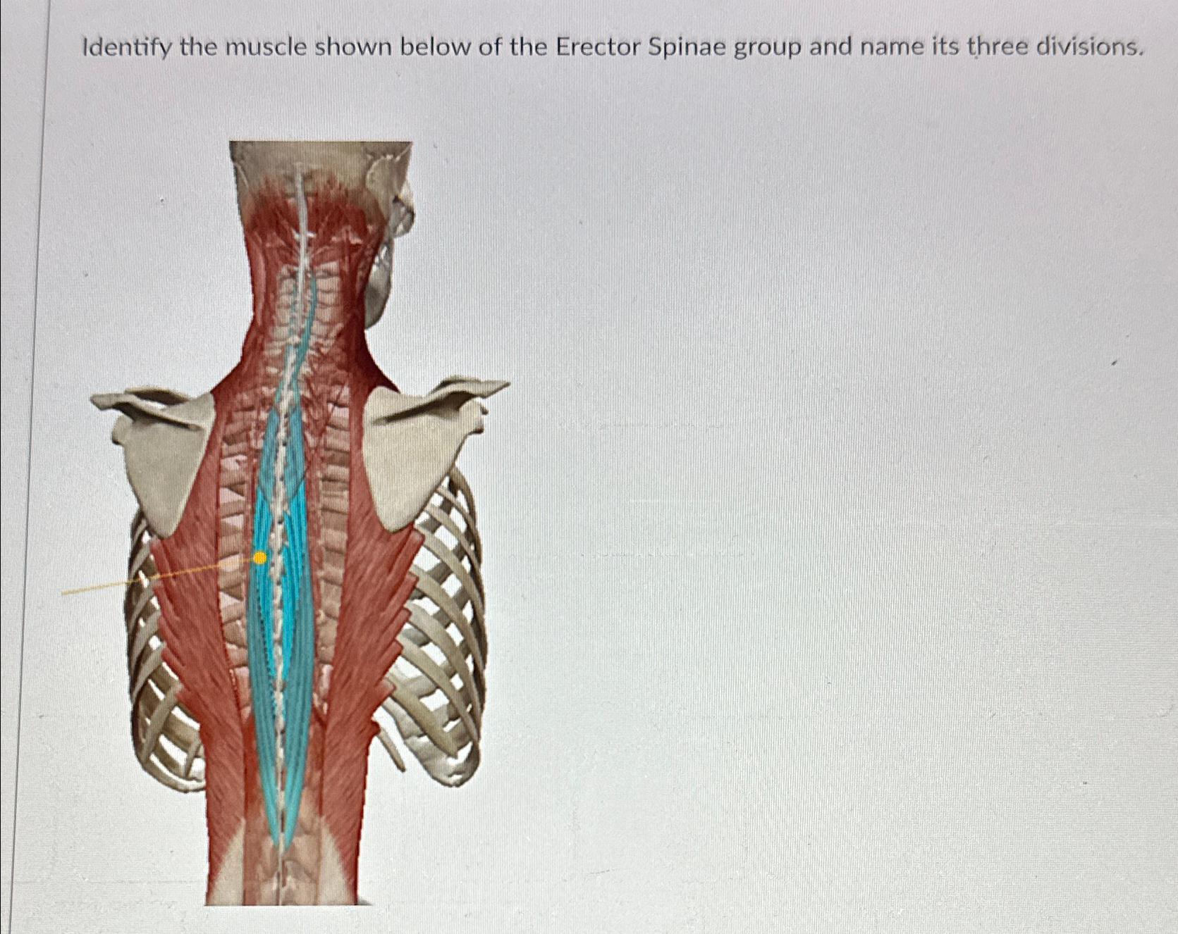 Solved Identify the muscle shown below of the Erector Spinae | Chegg.com