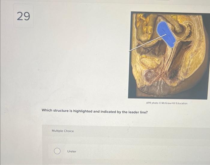 Solved Which structure is highlighted? Multiple Choice | Chegg.com
