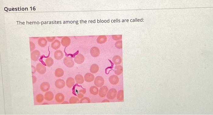 Solved Question 16 The hemo-parasites among the red blood | Chegg.com