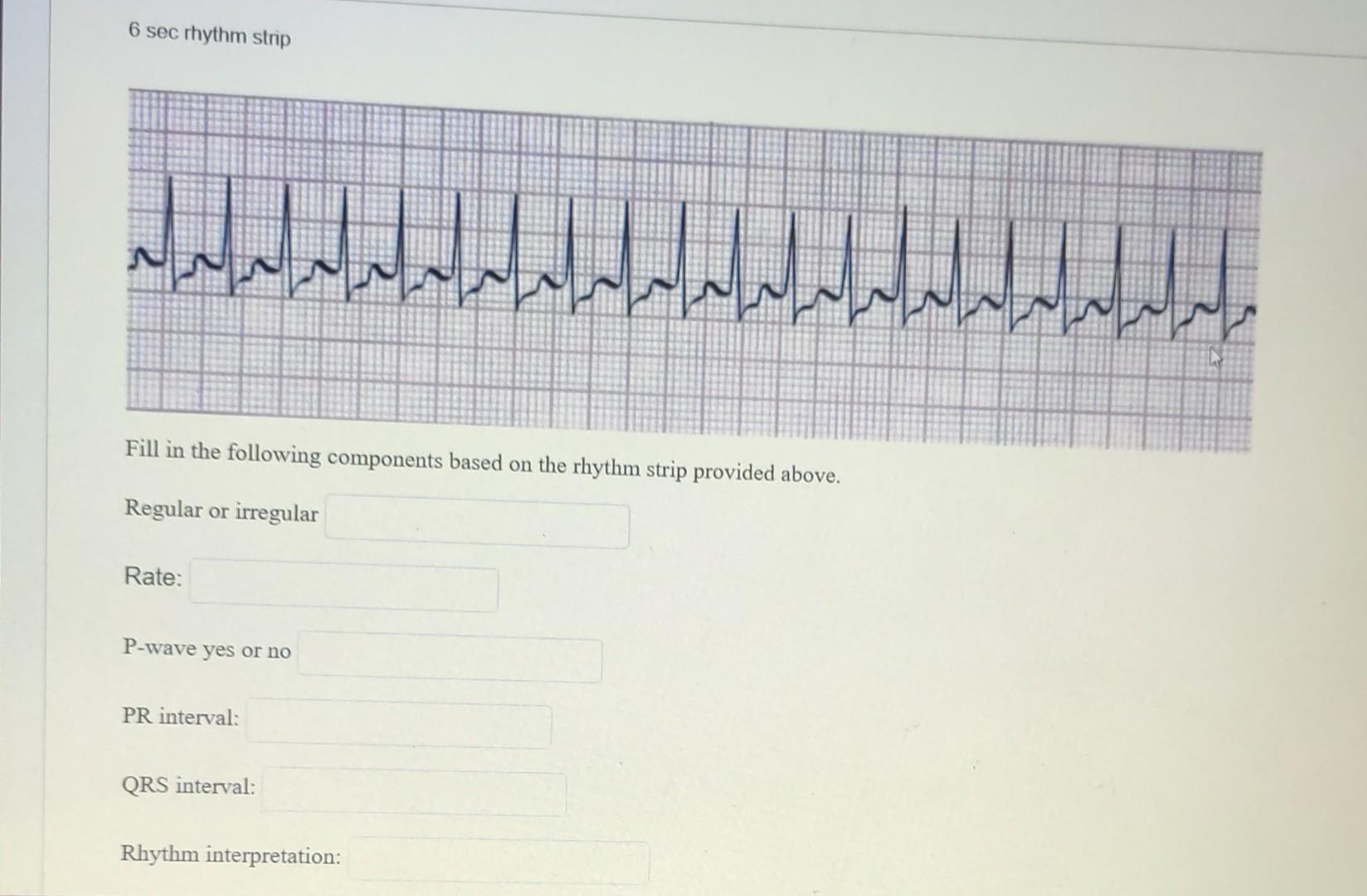 Solved FILL IN THE FOLLOWING COMPONENTS BASED ON THE RHYTHM | Chegg.com