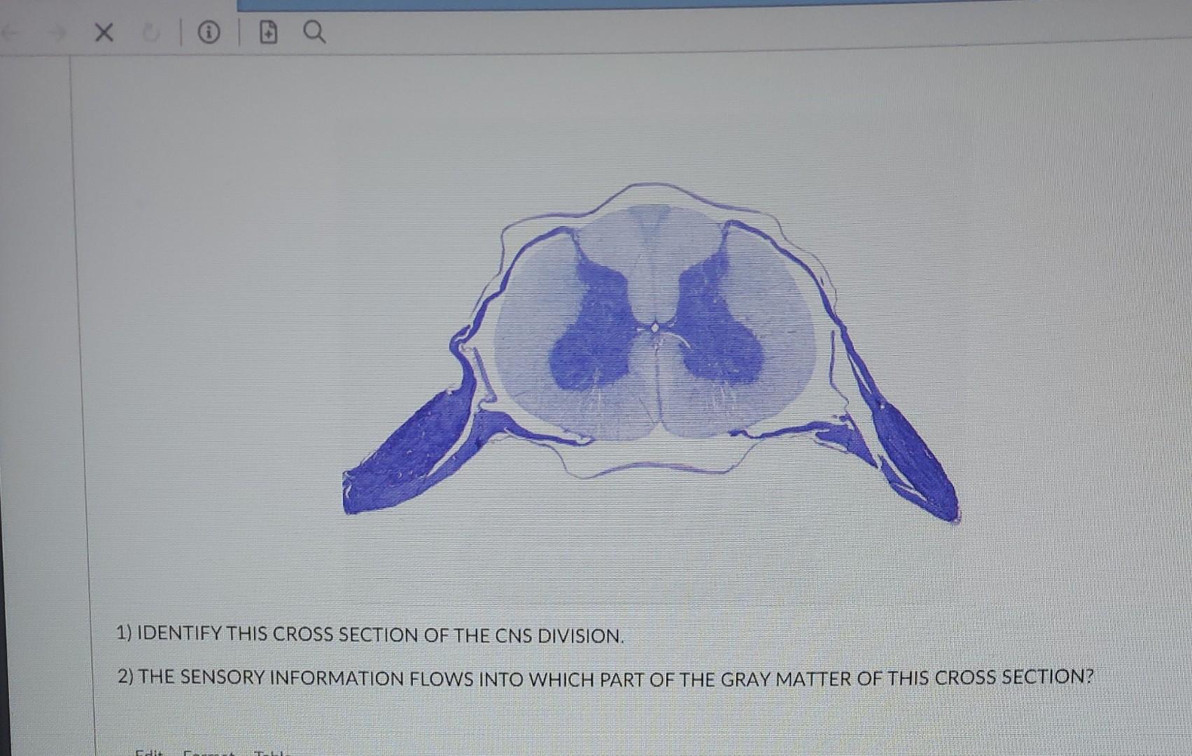 Solved 1) IDENTIFY THIS CROSS SECTION OF THE CNS DIVISION. | Chegg.com