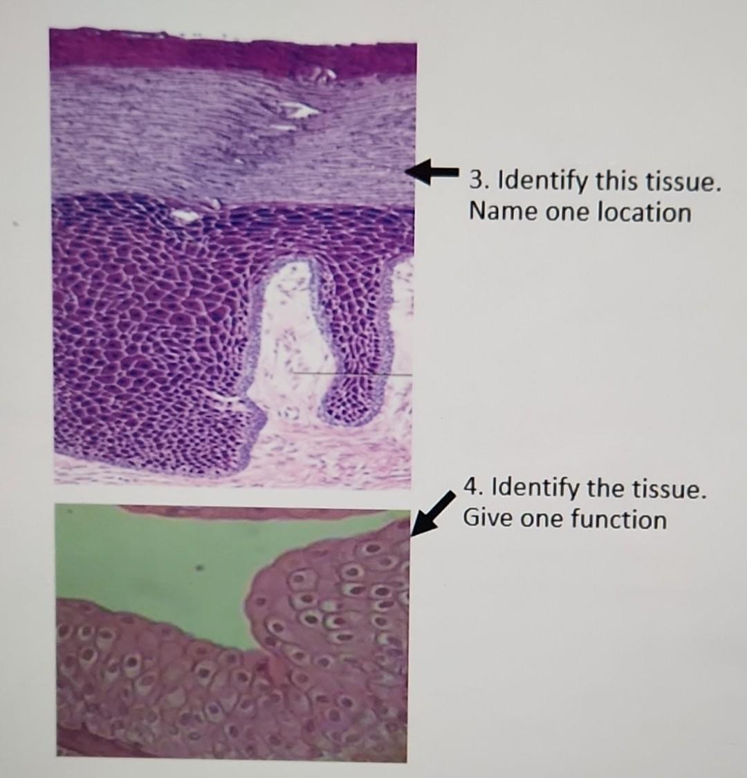 Solved 7. Identify this tissue. Give one location 8. | Chegg.com