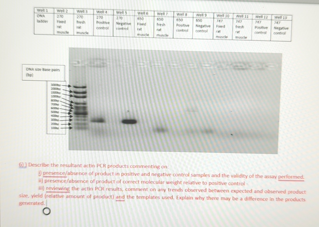 Solved Describe the resultant actin PCR products commenting | Chegg.com