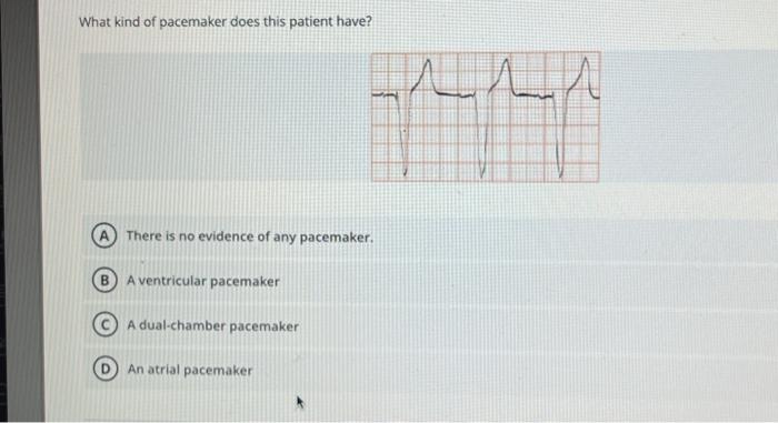 Solved What kind of pacemaker does this patient have? Free | Chegg.com