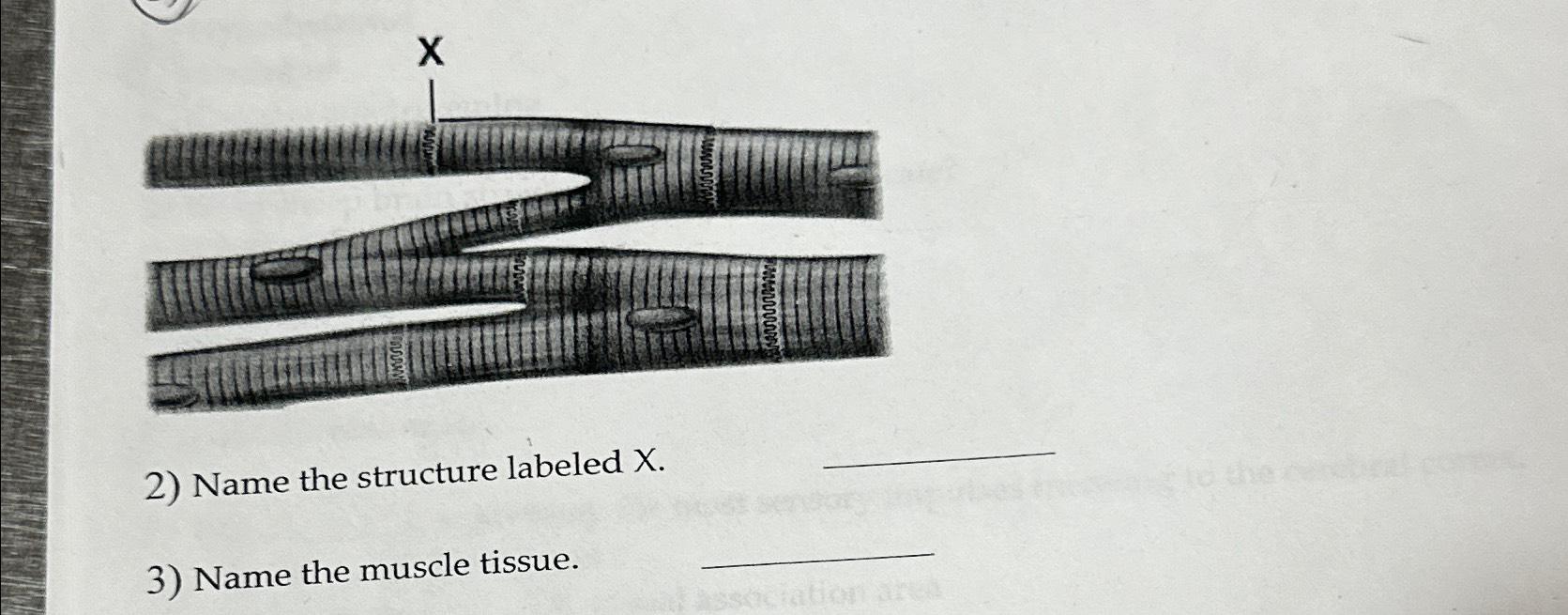 Solved Name the structure labeled x.Name the muscle tissue. | Chegg.com