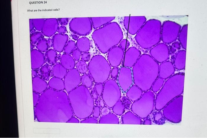 Solved What are the indicated colls? | Chegg.com