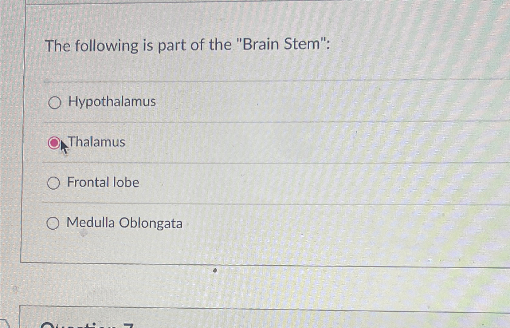 Solved The following is part of the "Brain | Chegg.com