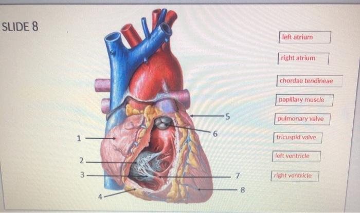 Solved SLIDE 6 left circumflex artery left marginal artery | Chegg.com