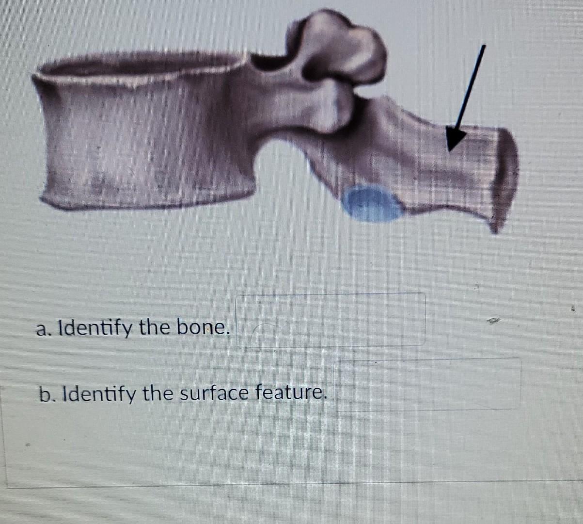 Solved a. Identify the bone. b. Identify the surface | Chegg.com