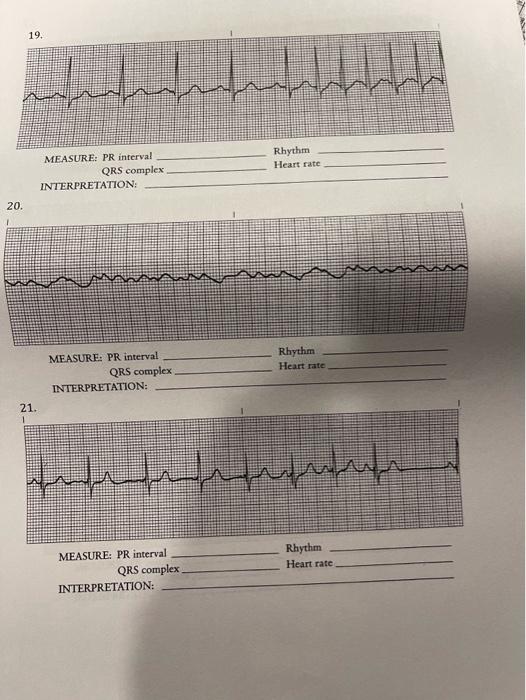QRS complex INTERPRETATION: MEASURE: PR interval | Chegg.com