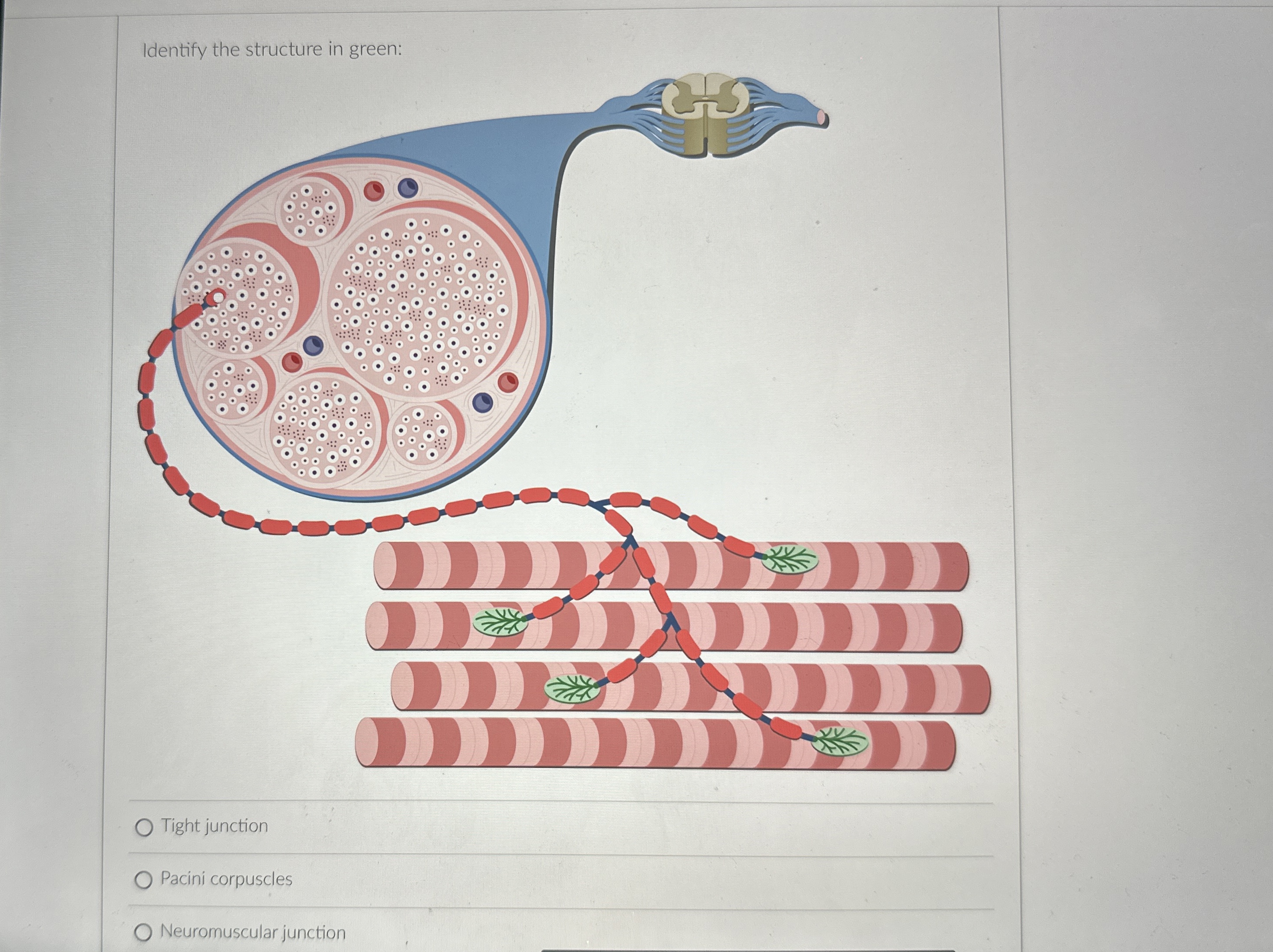 Solved Identify the structure in green:Tight junctionPacini | Chegg.com