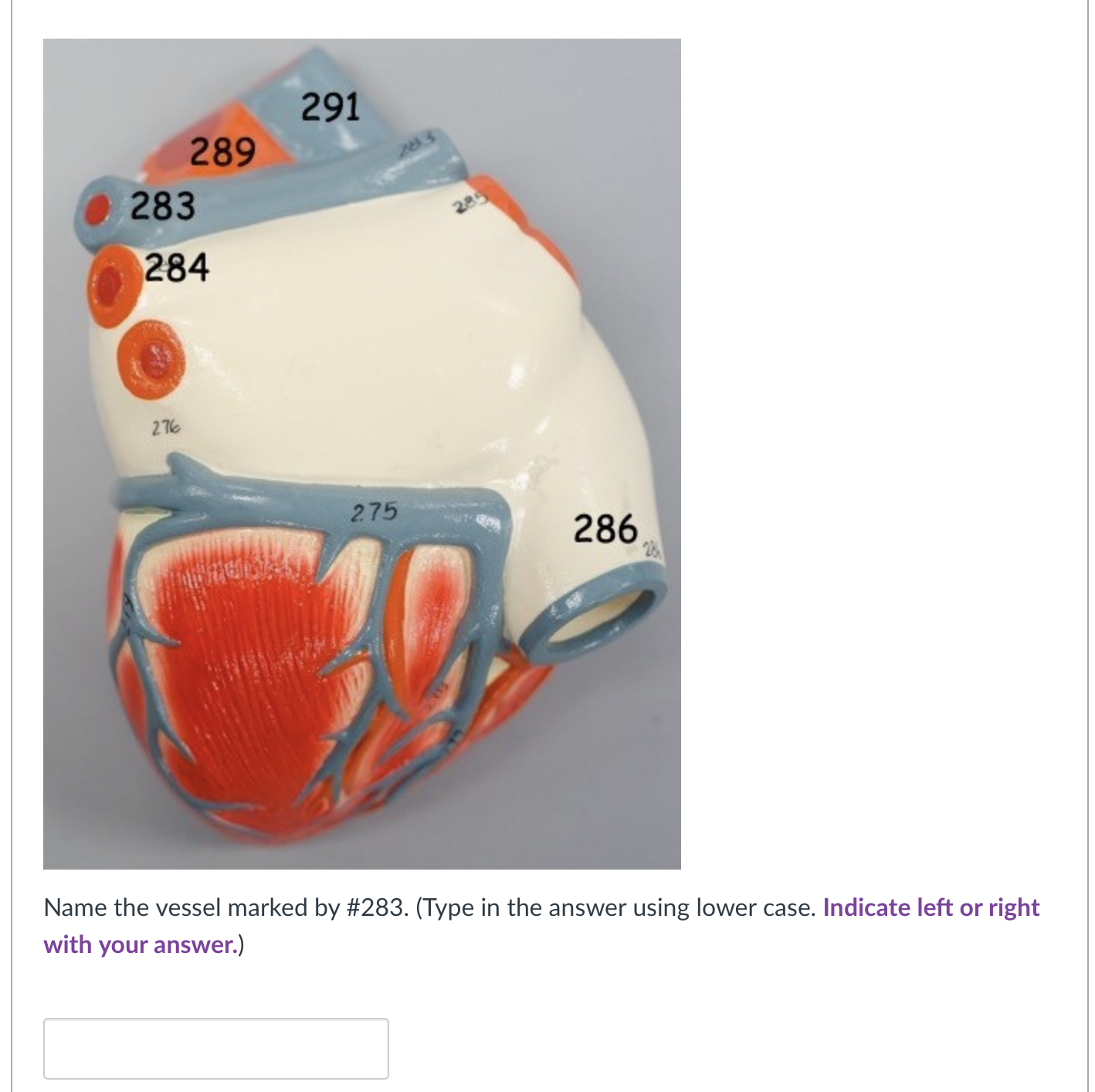 Solved Name the vessel marked by #283. (Type in the answer | Chegg.com